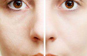 Pitiriasi rosea di Gibert: cause, sintomi e cura - Sanioggi.it