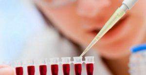 Piastrinopenia o piastrine basse: quando preoccuparsi? Cause, sintomi e ...