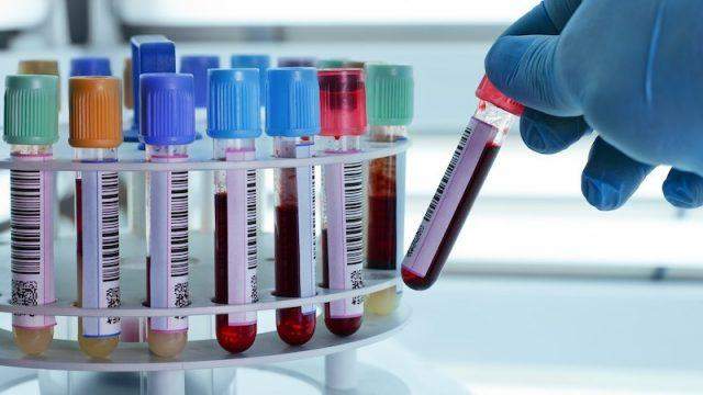 Piastrinopenia o piastrine basse: quando preoccuparsi? Cause, sintomi e ...