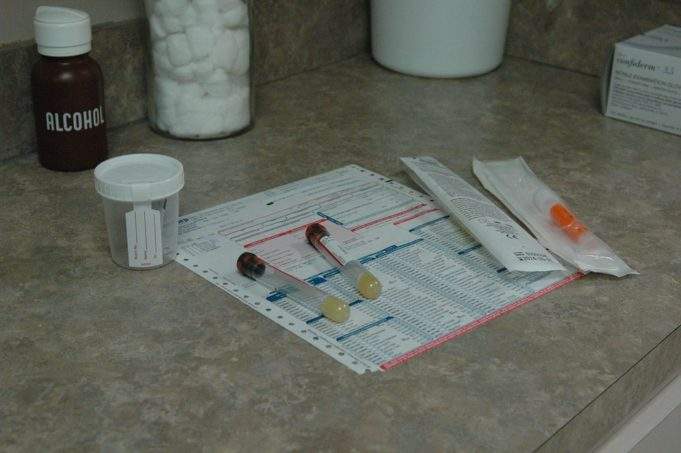 Urobilinogeno alto e basso nelle urine: valori, cause, sintomi e cura